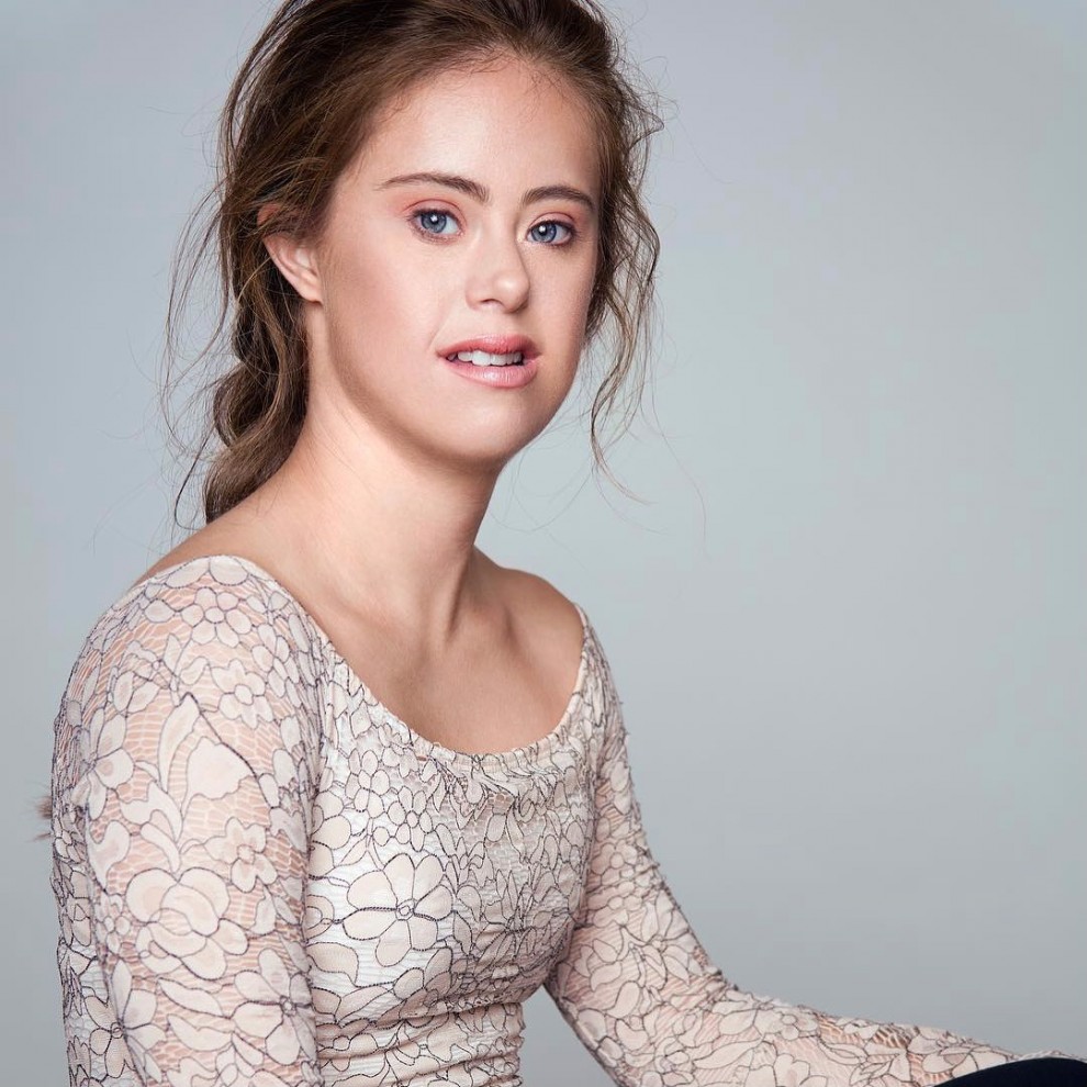¡no Existen Límites Chica Con Síndrome De Down Es Modelo Y Gimnasta Radiohouse